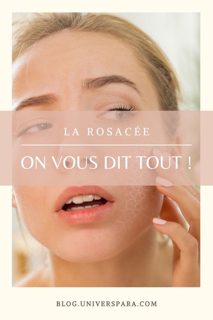 La rosacée, ou quand la peau fait sa révolution